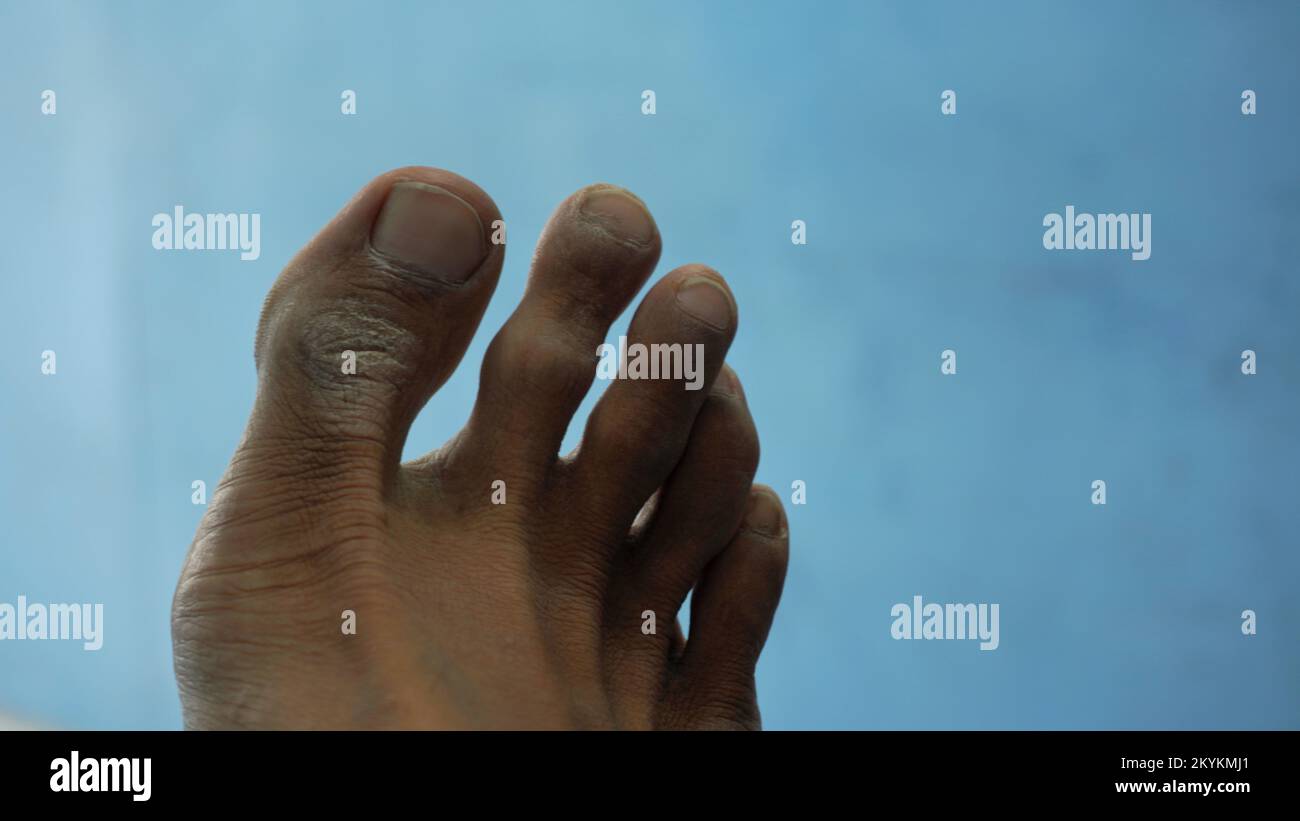 Human leg close up skin hi-res stock photography and images - Alamy