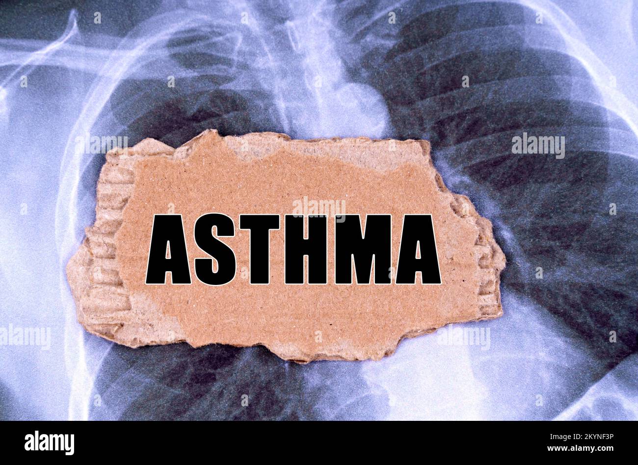 Medicine concept. On the X-ray there is a piece of cardboard with the ...