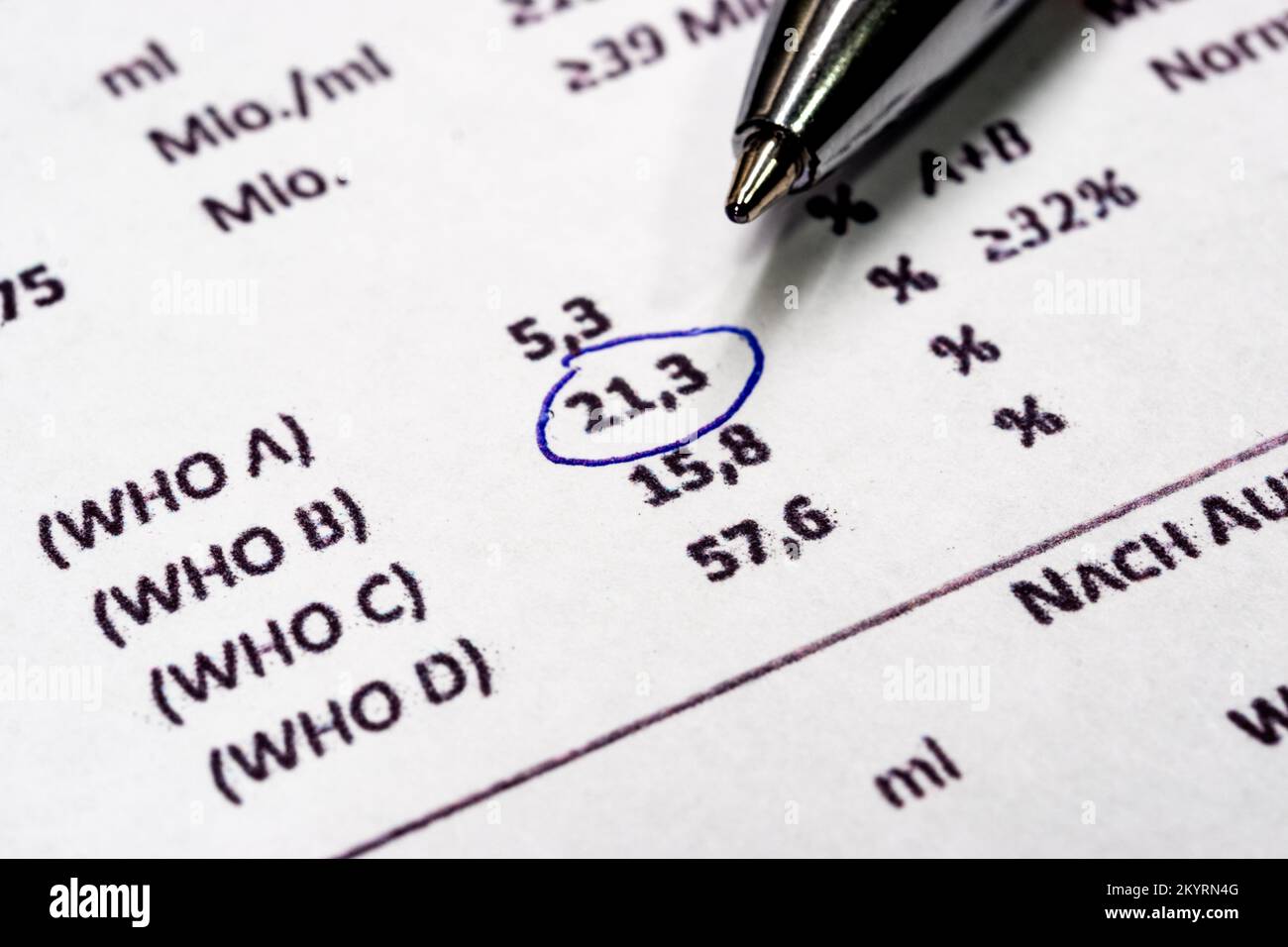 Semen analysis showing WHO sperm motility values of an infertile man ...