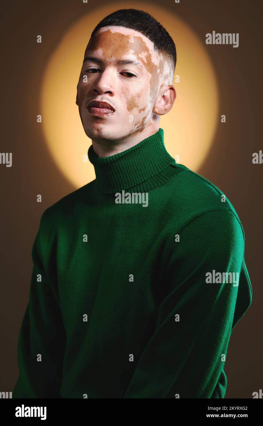 Vitiligo, portrait and male fashion model in stylish, trendy and ...
