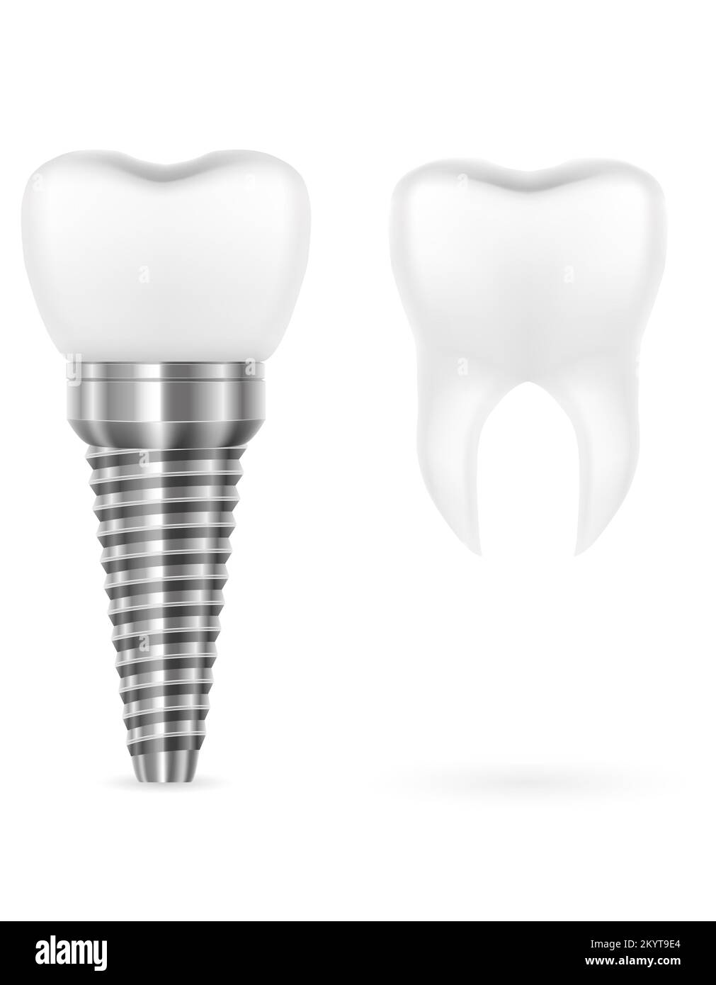metal human tooth implant vector illustration isolated on white ...