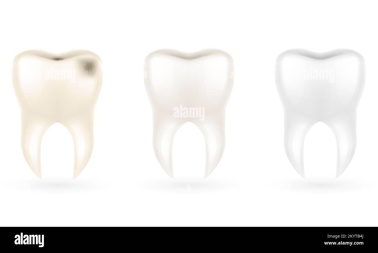 human root tooth model vector illustration isolated on white background ...