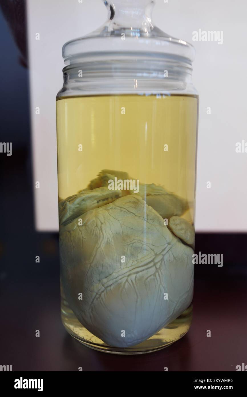 Pig heart Preserved in a Yellow Liquid in a Glass Jar Stock Photo - Alamy
