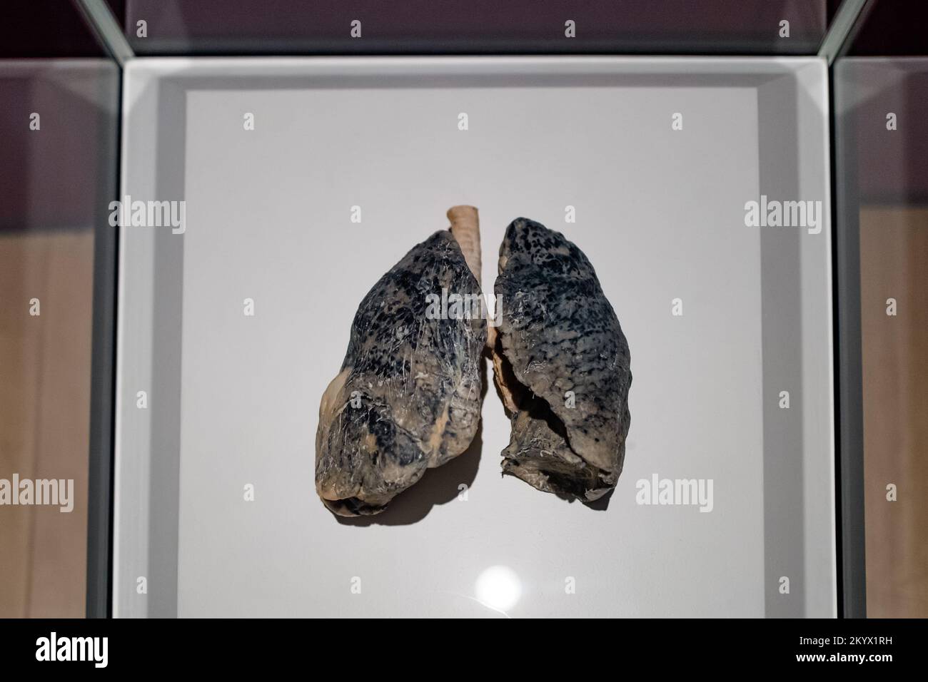 Bari, Italy. 02nd Dec, 2022. Detail of the lungs of a human body posing ...