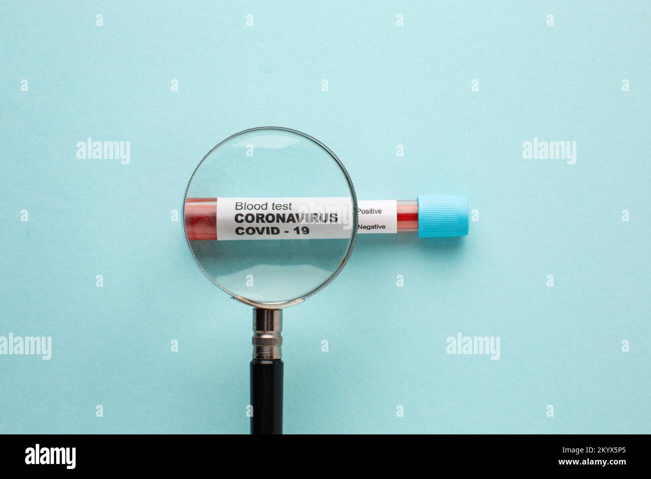 Positive blood test result for the new rapidly spreading Coronavirus ...