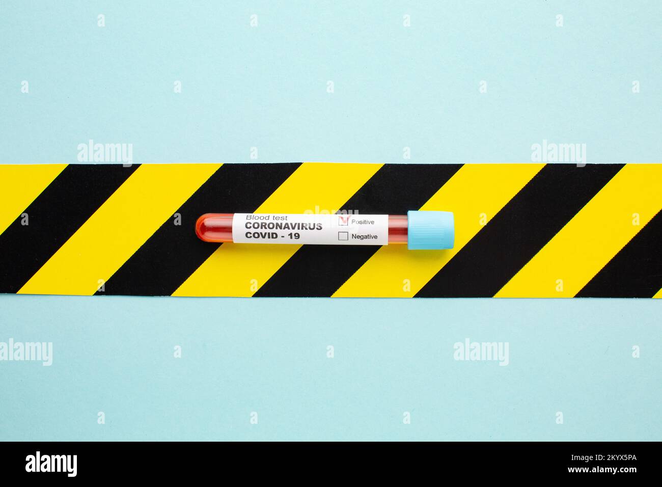 Positive blood test result for the new rapidly spreading Coronavirus ...