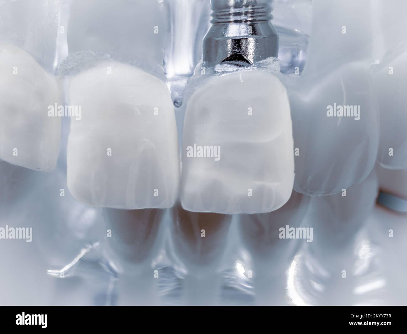 Reflective practise hi-res stock photography and images - Alamy