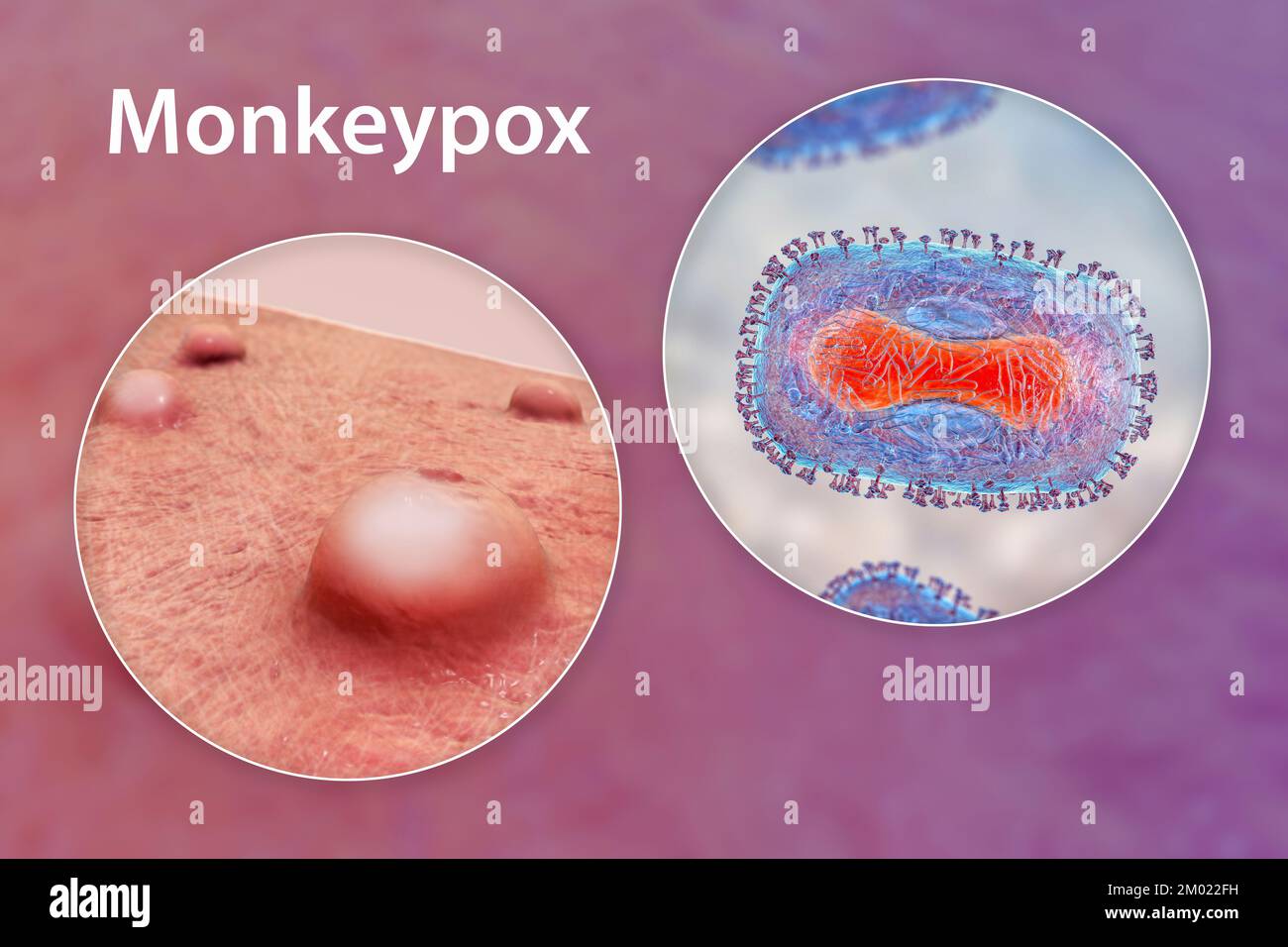 Monkeypox virus structure hi-res stock photography and images - Alamy