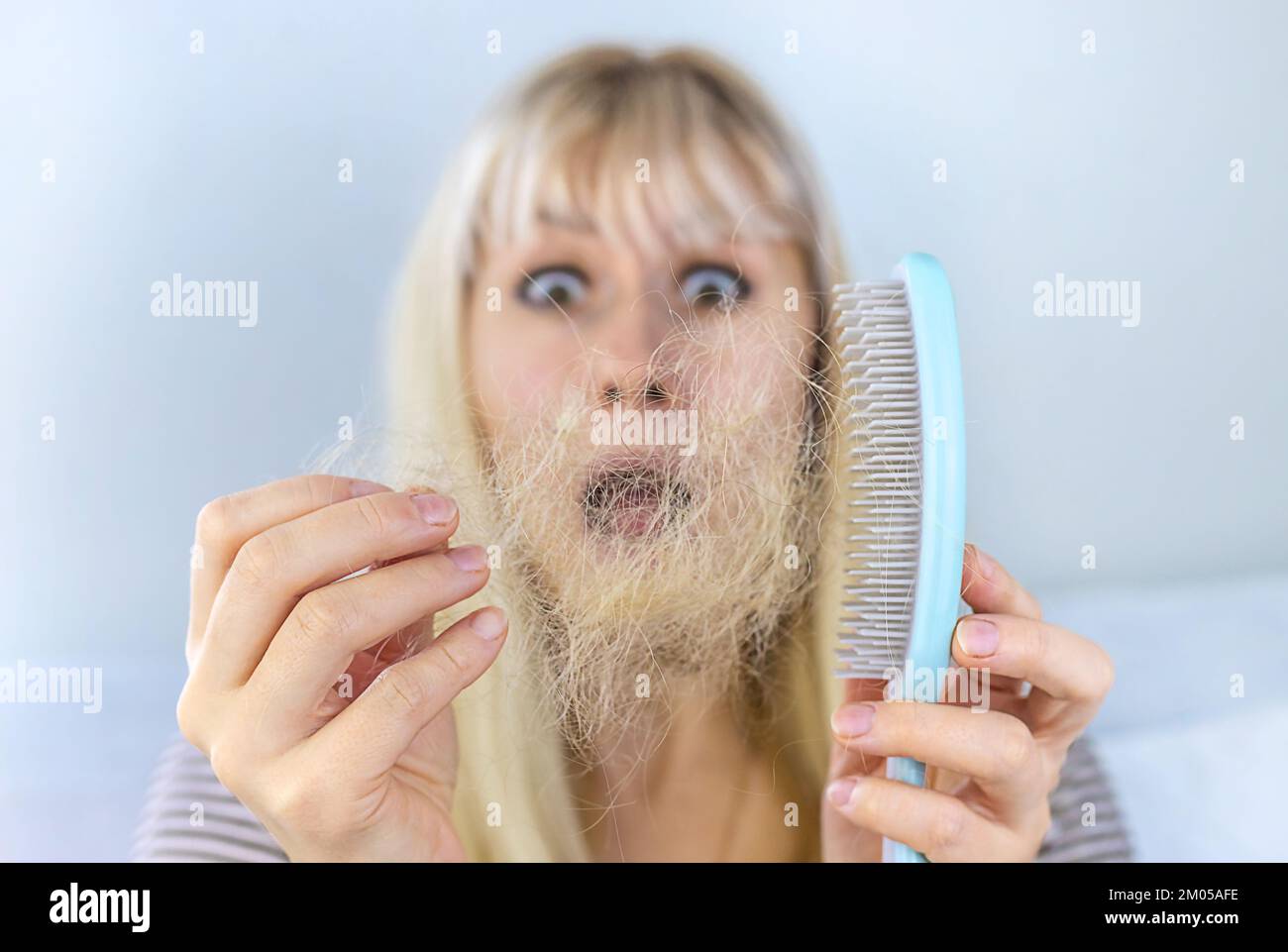 The woman hair is falling out. Selective focus. People Stock Photo - Alamy