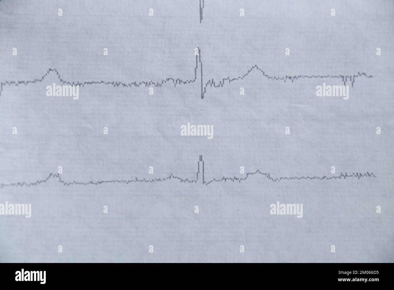 cardiogram on old paper as background macro photo Stock Photo - Alamy