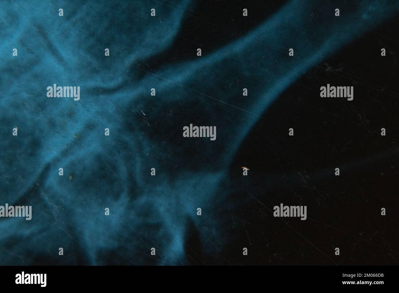 X-ray of an elderly person with osteoporosis and arthritis arthrosis ...