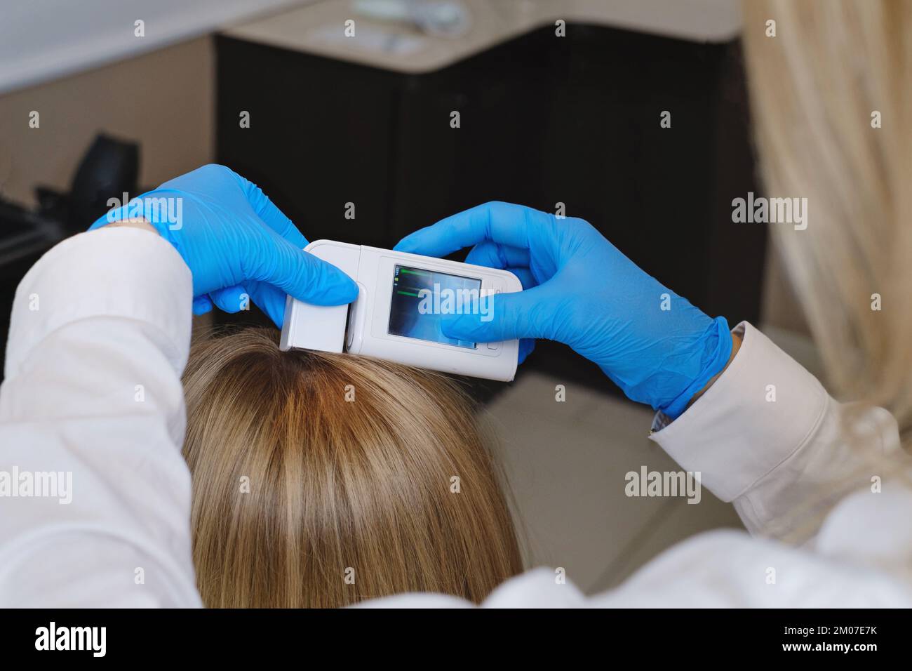 Close up view of the female trihologist examines head skin of woman ...