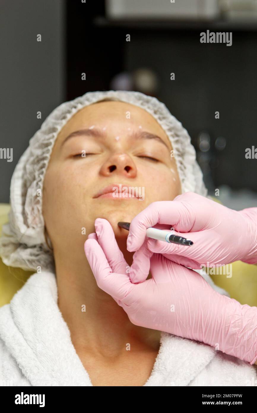 Attractive girl patient with instructions on her face for plastic ...