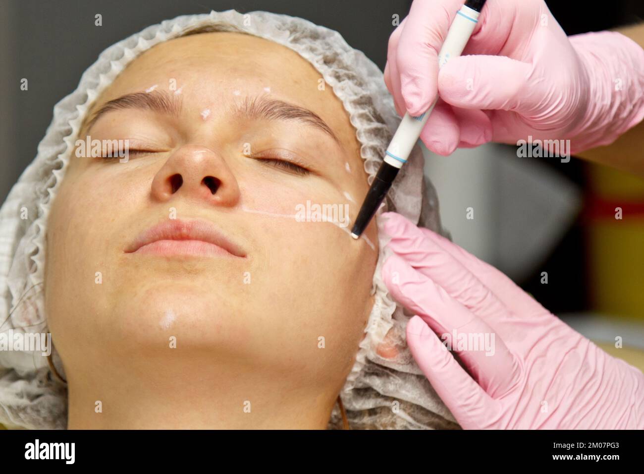 Attractive girl patient with instructions on her face for plastic ...