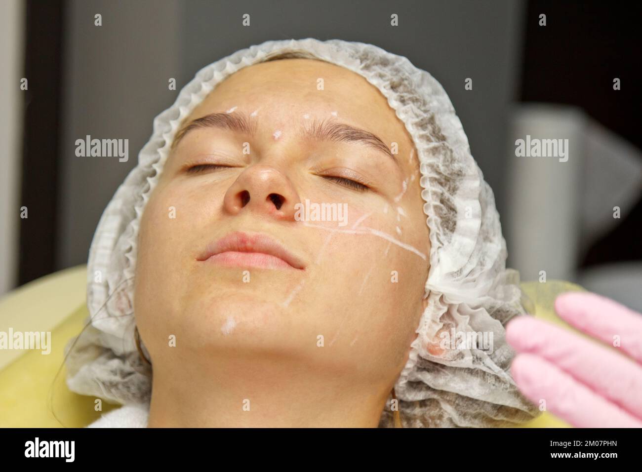 Attractive girl patient with instructions on her face for plastic ...