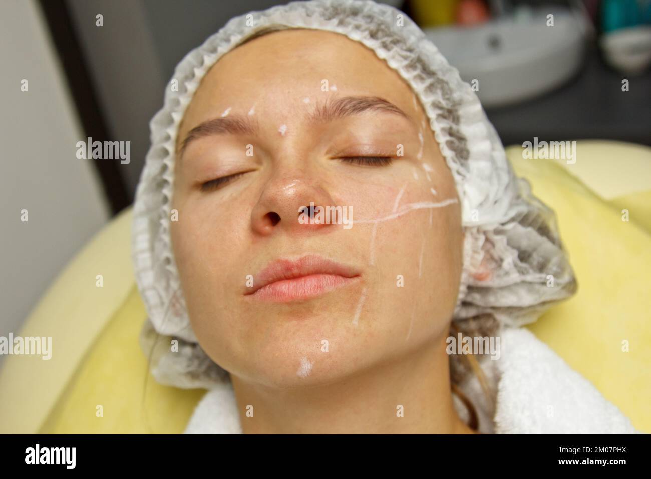 Attractive girl patient with instructions on her face for plastic ...