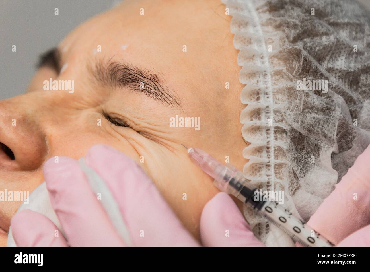 contour plastic. A cosmetologist injects a botulinum toxin to tighten ...