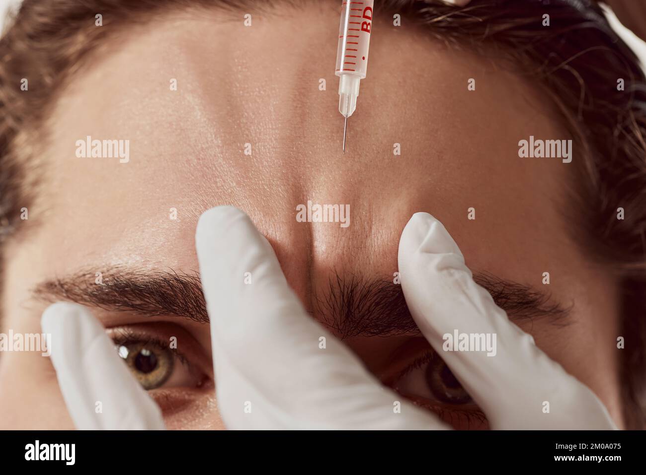 Cropped image of man's forehead and cosmetologist's hands making anti ...
