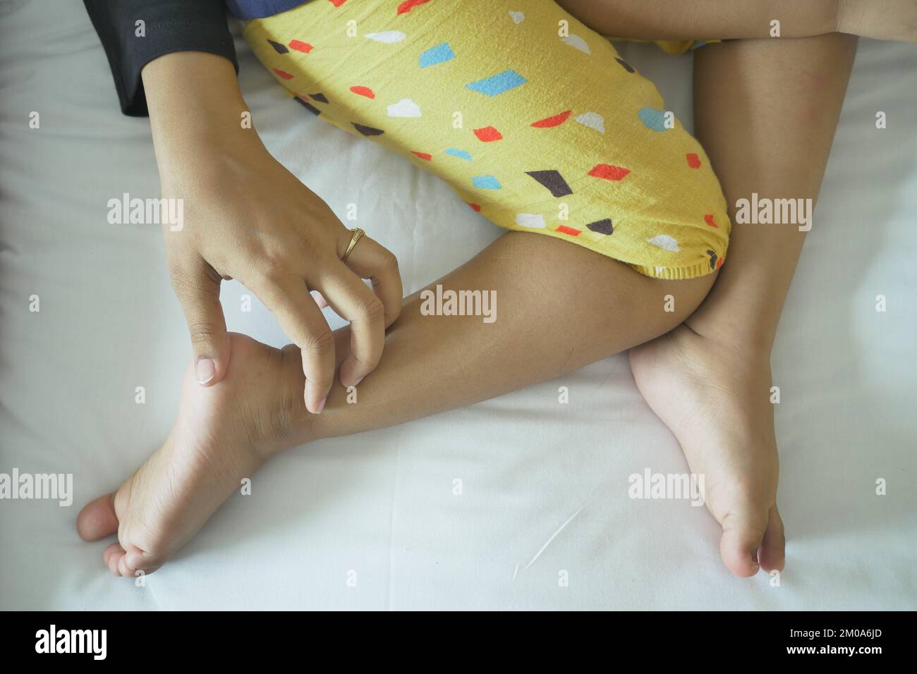 child girl suffering from itching skin, close up Stock Photo - Alamy