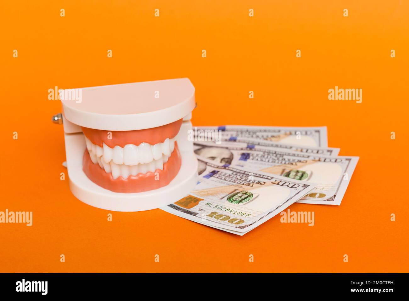 Closeup model of a human jaw with white teeth and dollar bill ...