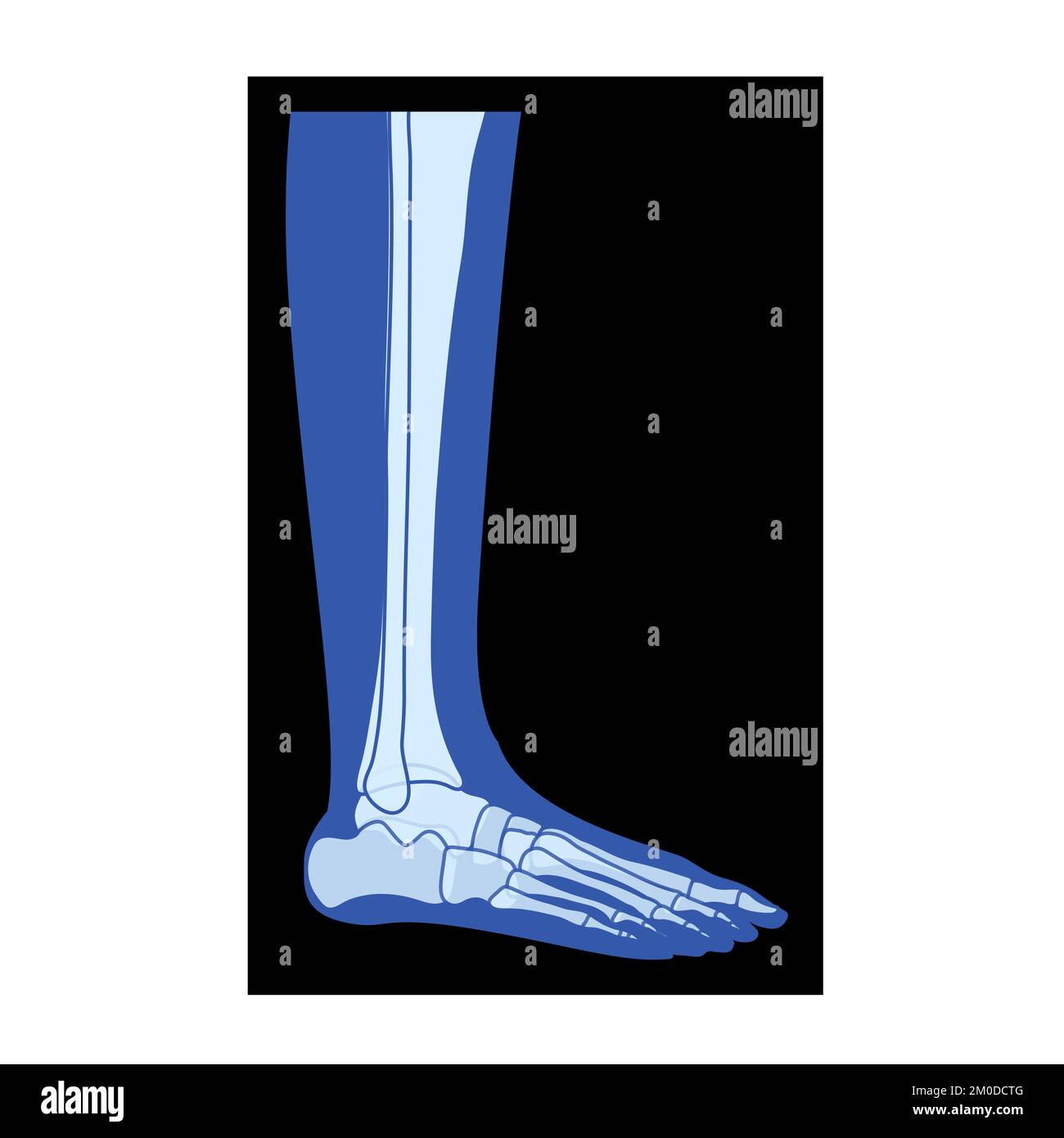 X-Ray Foot Legs Skeleton, Fibula, Tibia - Phalanges Human body, Bones ...