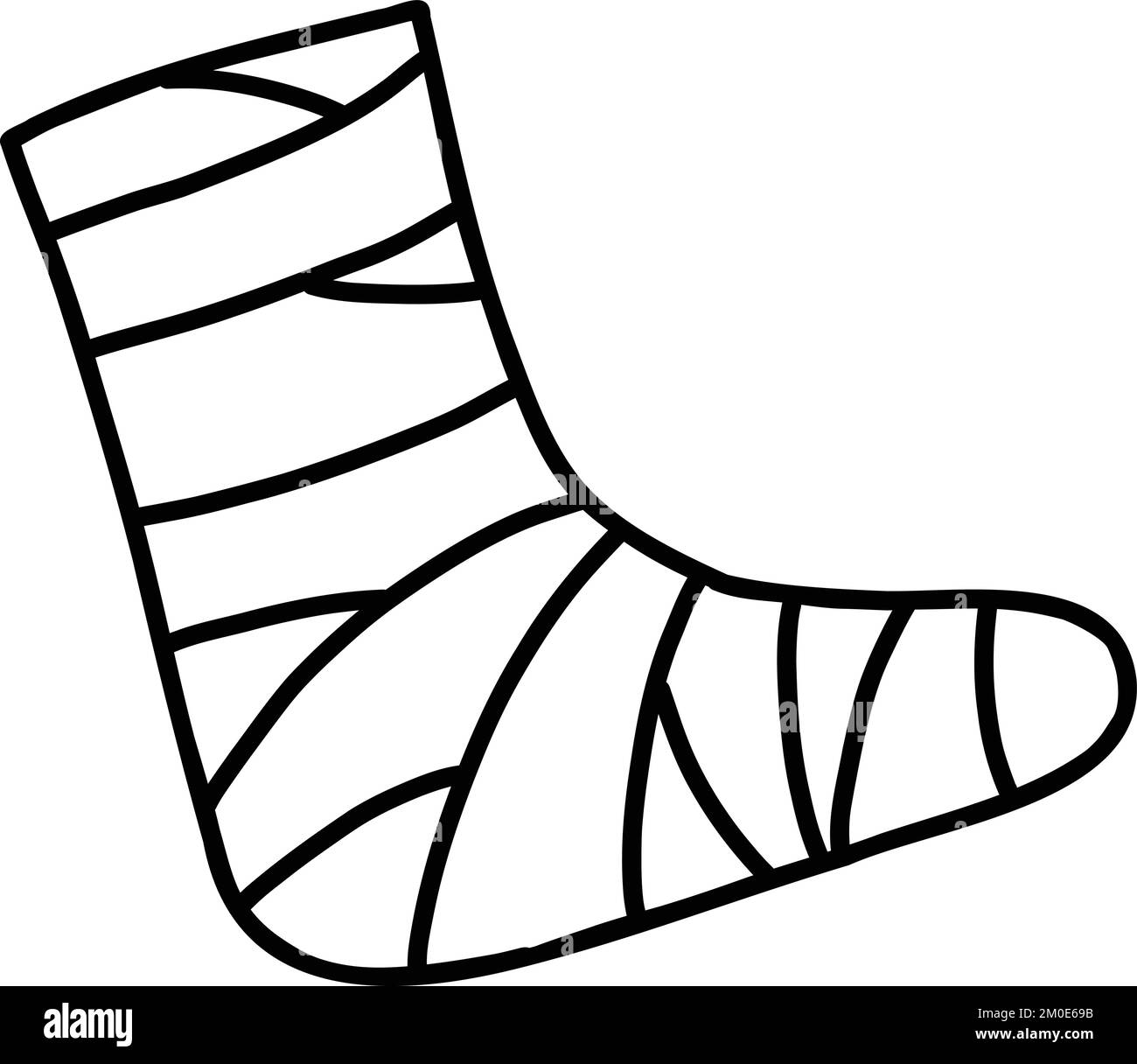 Hand Drawn Splint foot illustration isolated on background Stock Vector ...