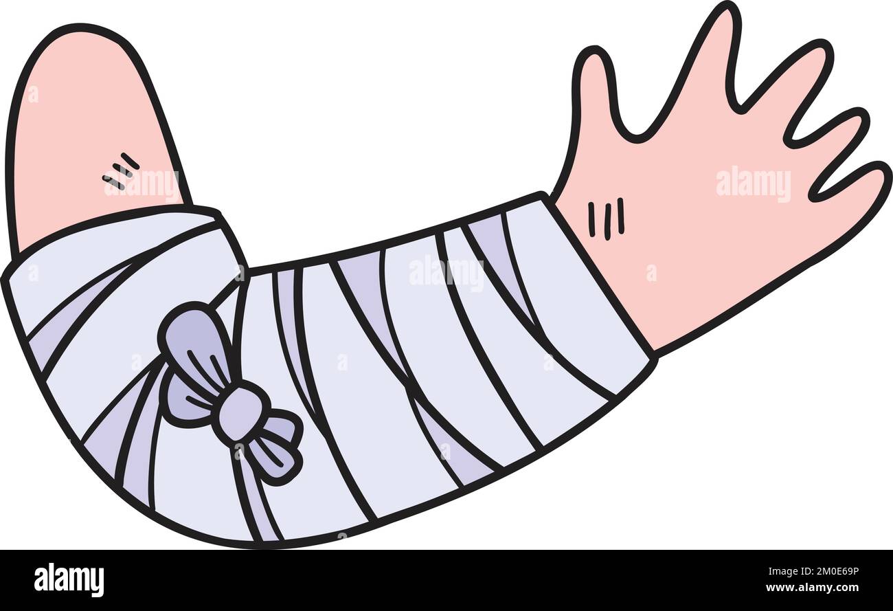 Arm Cast Clipart