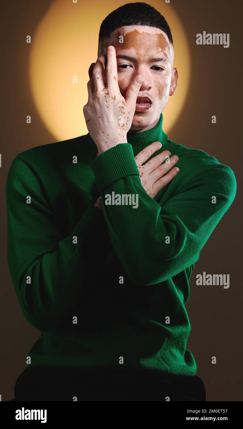 Vitiligo, fashion and portrait of a man with designer clothes for art ...