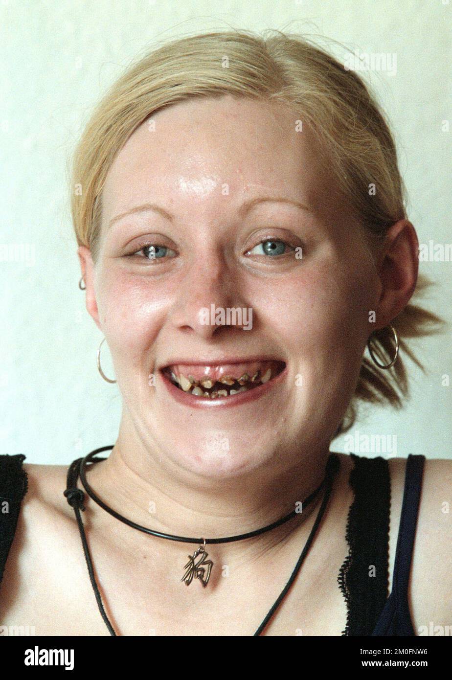 My teeth have been ruined by coca cola hi-res stock photography and ...