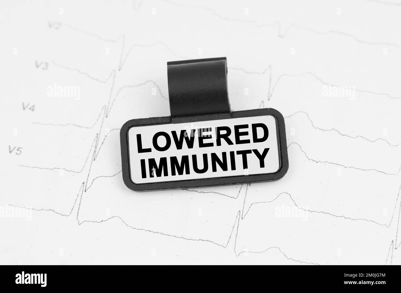 Medicine and health concept. There is a plate on the cardiogram with ...