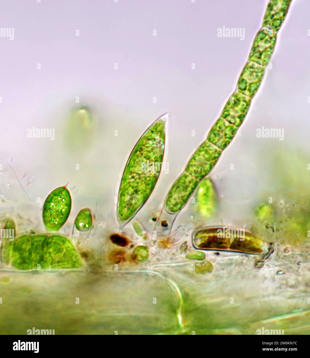 Microalgae settled on Lemna sp. root, light micrograph Stock Photo - Alamy