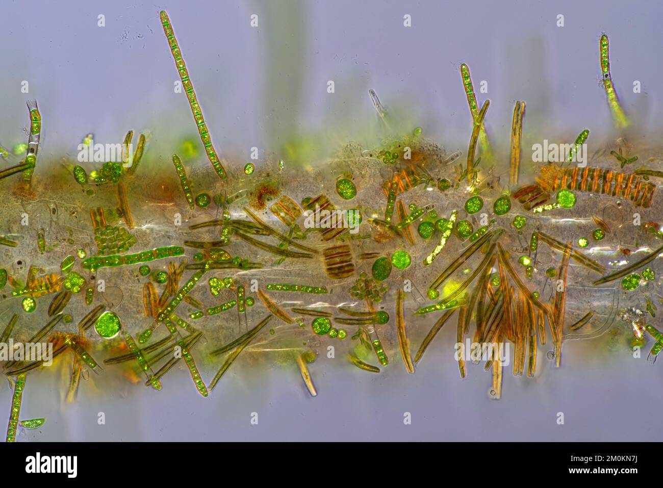 Microalgae settled on Lemna sp. root, light micrograph Stock Photo - Alamy