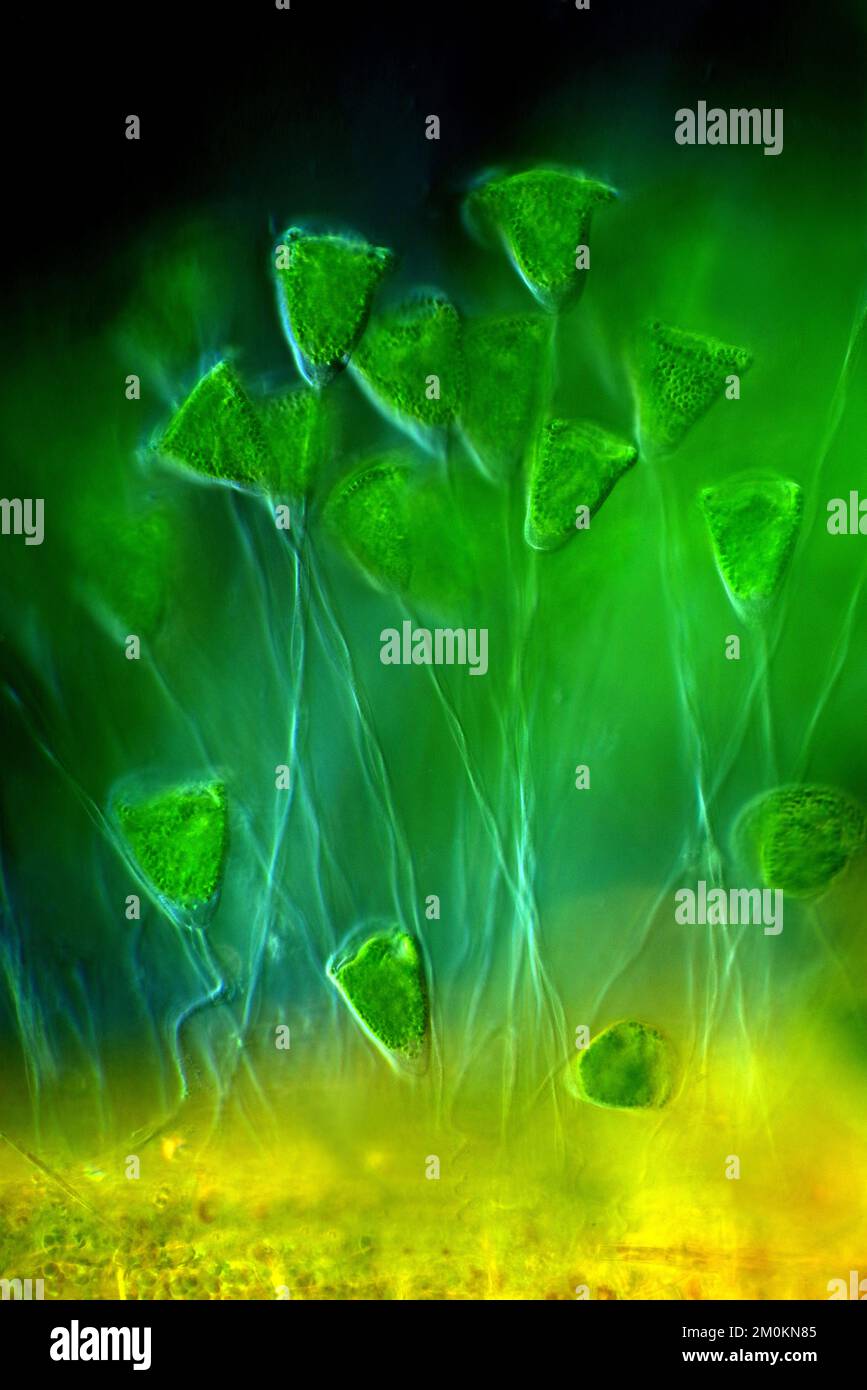 Vorticella protozoa, polarised light micrograph Stock Photo - Alamy Vorticella protozoa, polarised light micrograph Stock Photo - Alamy