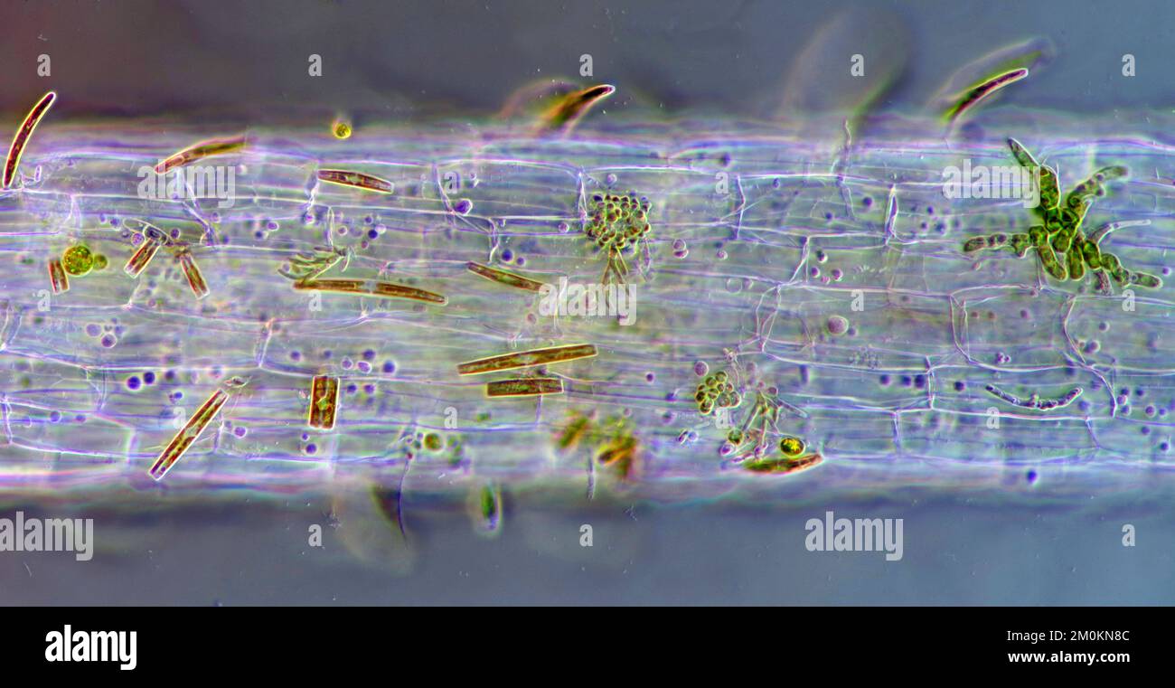 Microalgae settled on Lemna sp. root, light micrograph Stock Photo - Alamy