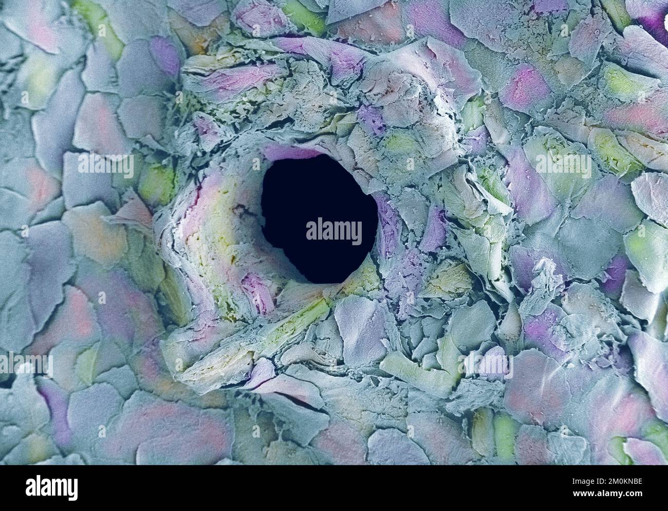 Tattoo needle puncture in skin, SEM Stock Photo - Alamy