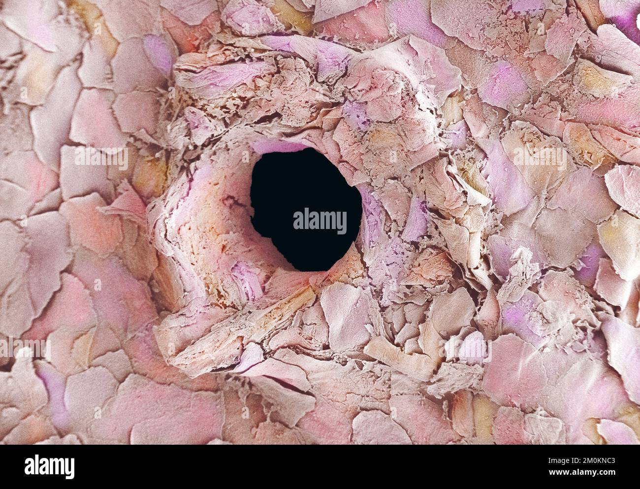 Tattoo needle puncture in skin, SEM Stock Photo - Alamy