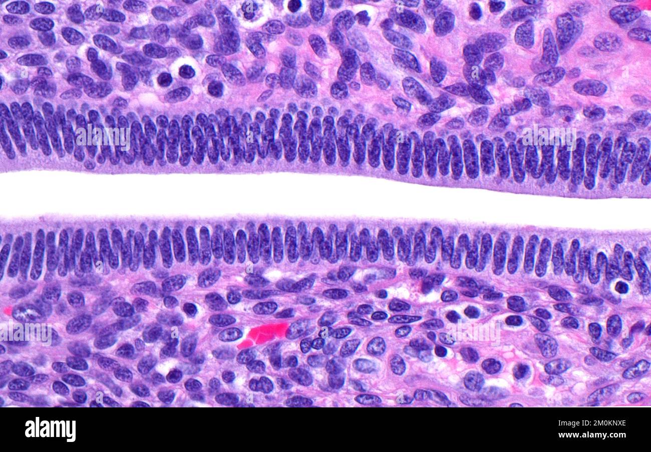 Uterus lining gland cells, light micrograph Stock Photo - Alamy