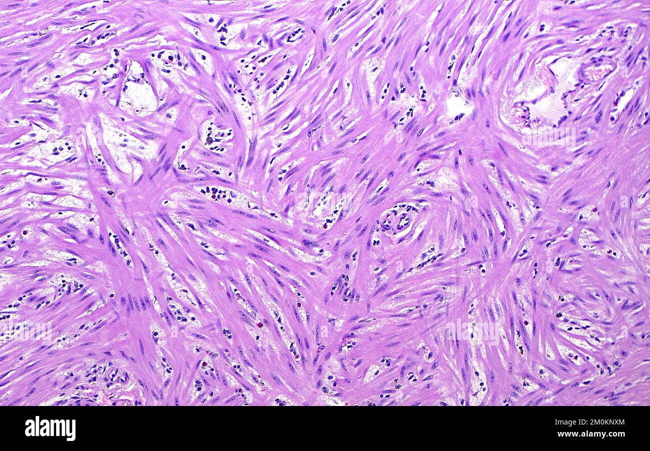 Smooth muscle cells in stomach, light micrograph Stock Photo - Alamy