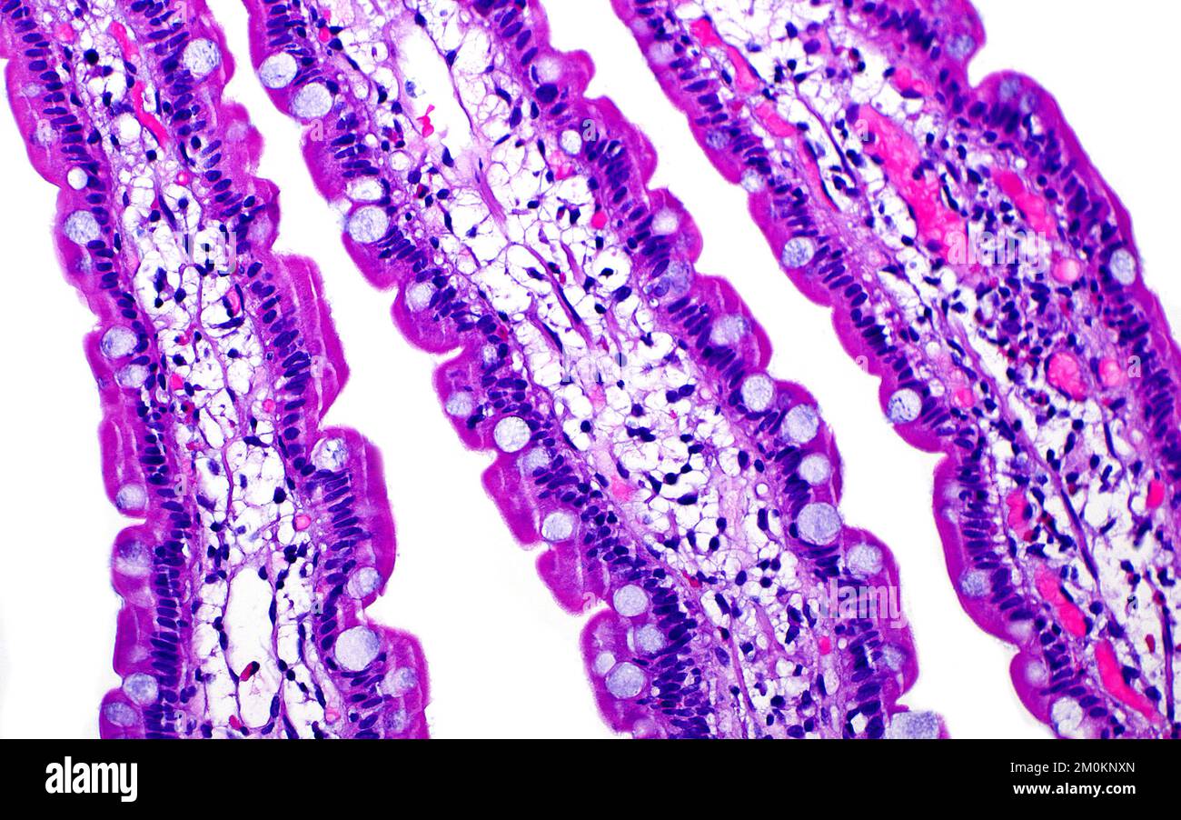 Small intestinal villi, light micrograph Stock Photo - Alamy