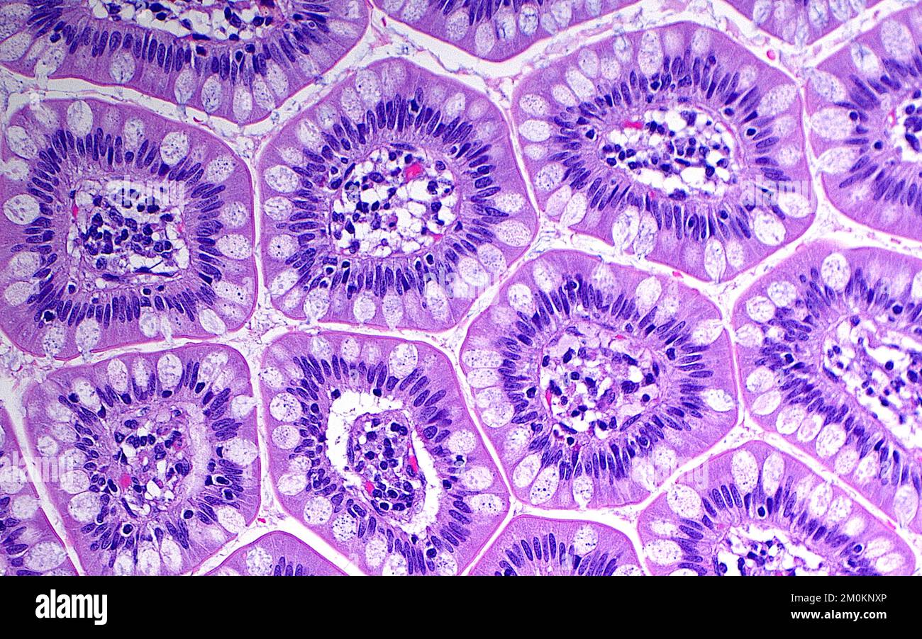 Small intestine cells, light micrograph Stock Photo - Alamy