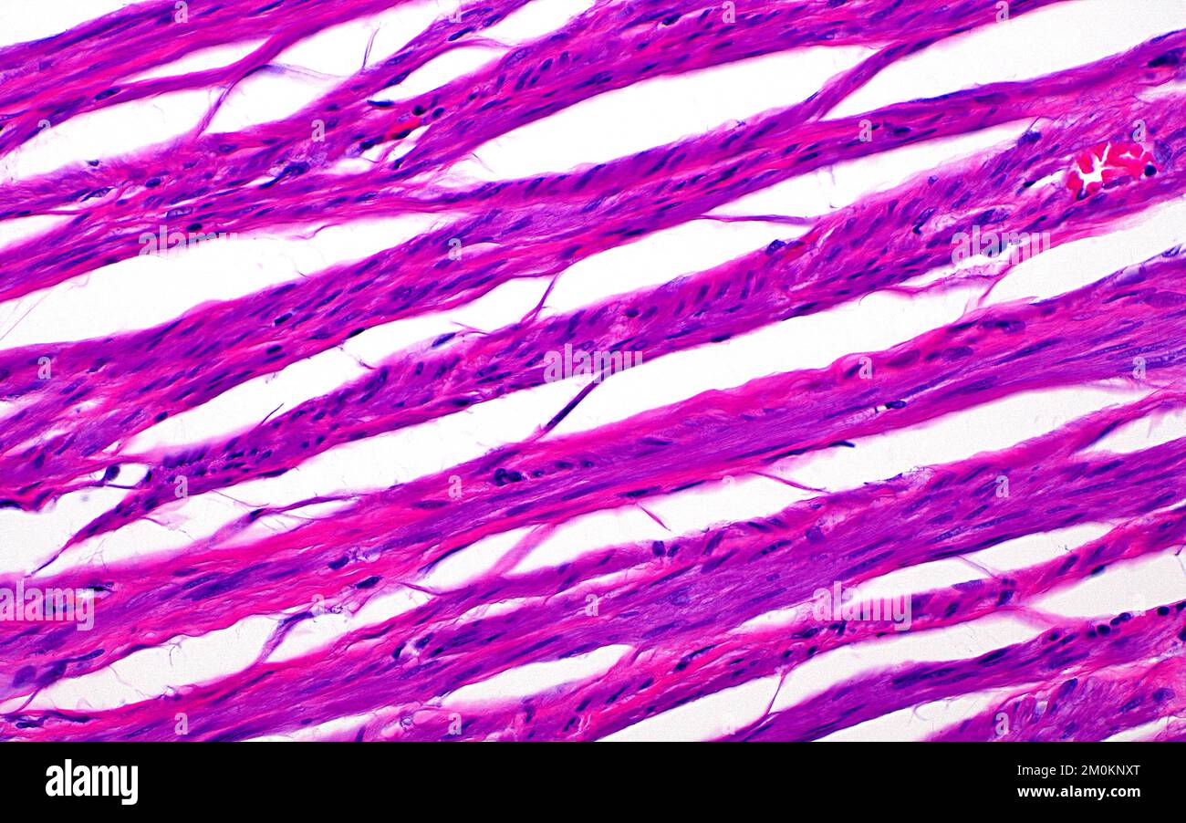 Smooth muscle in prostate, light micrograph Stock Photo - Alamy