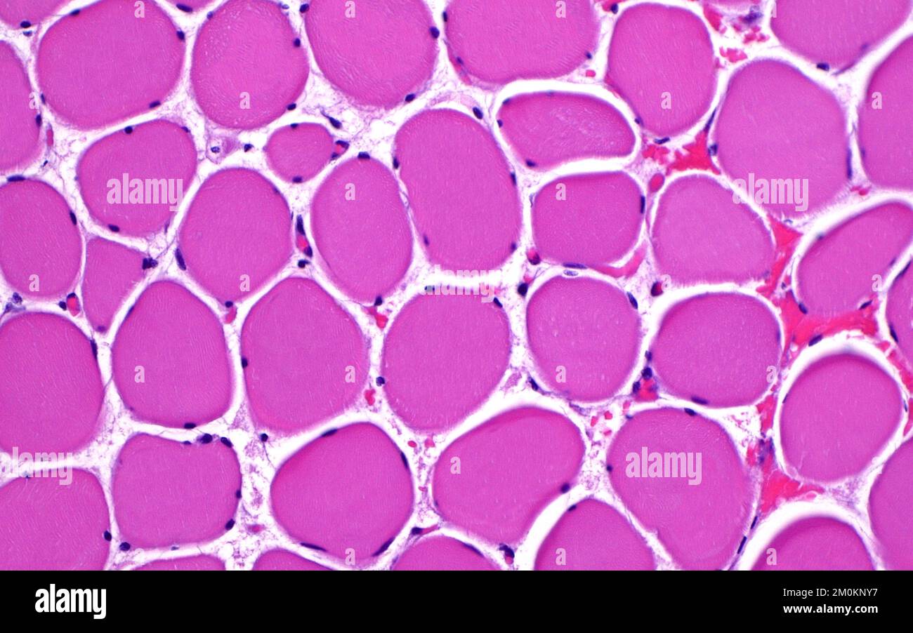 Skeletal muscle cells, light micrograph Stock Photo - Alamy