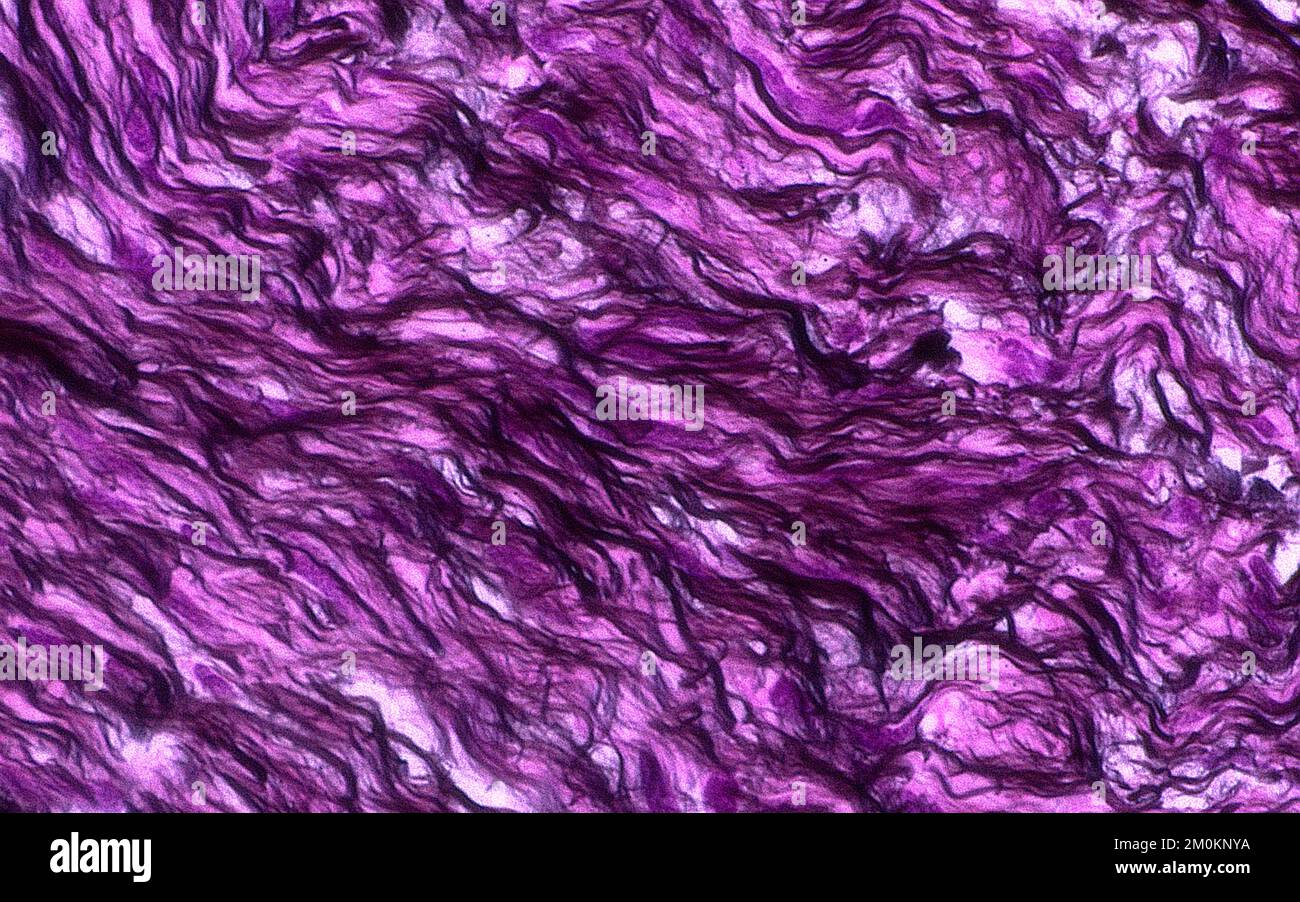 Collagen fibres silver stained, light micrograph Stock Photo - Alamy