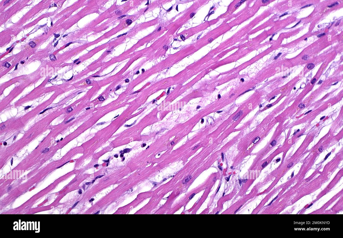 Heart muscle cells, light micrograph Stock Photo - Alamy