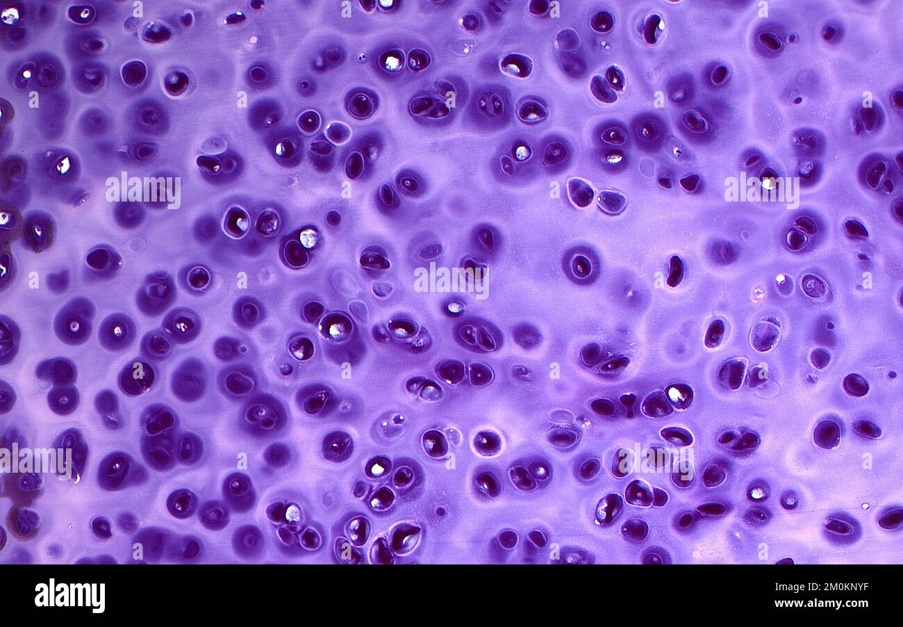 Human cartilage, light micrograph Stock Photo - Alamy