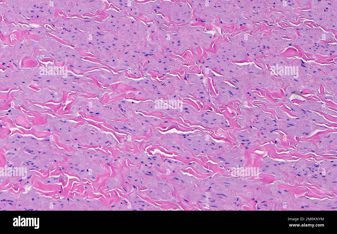 Smooth muscle in renal vein, light micrograph Stock Photo - Alamy