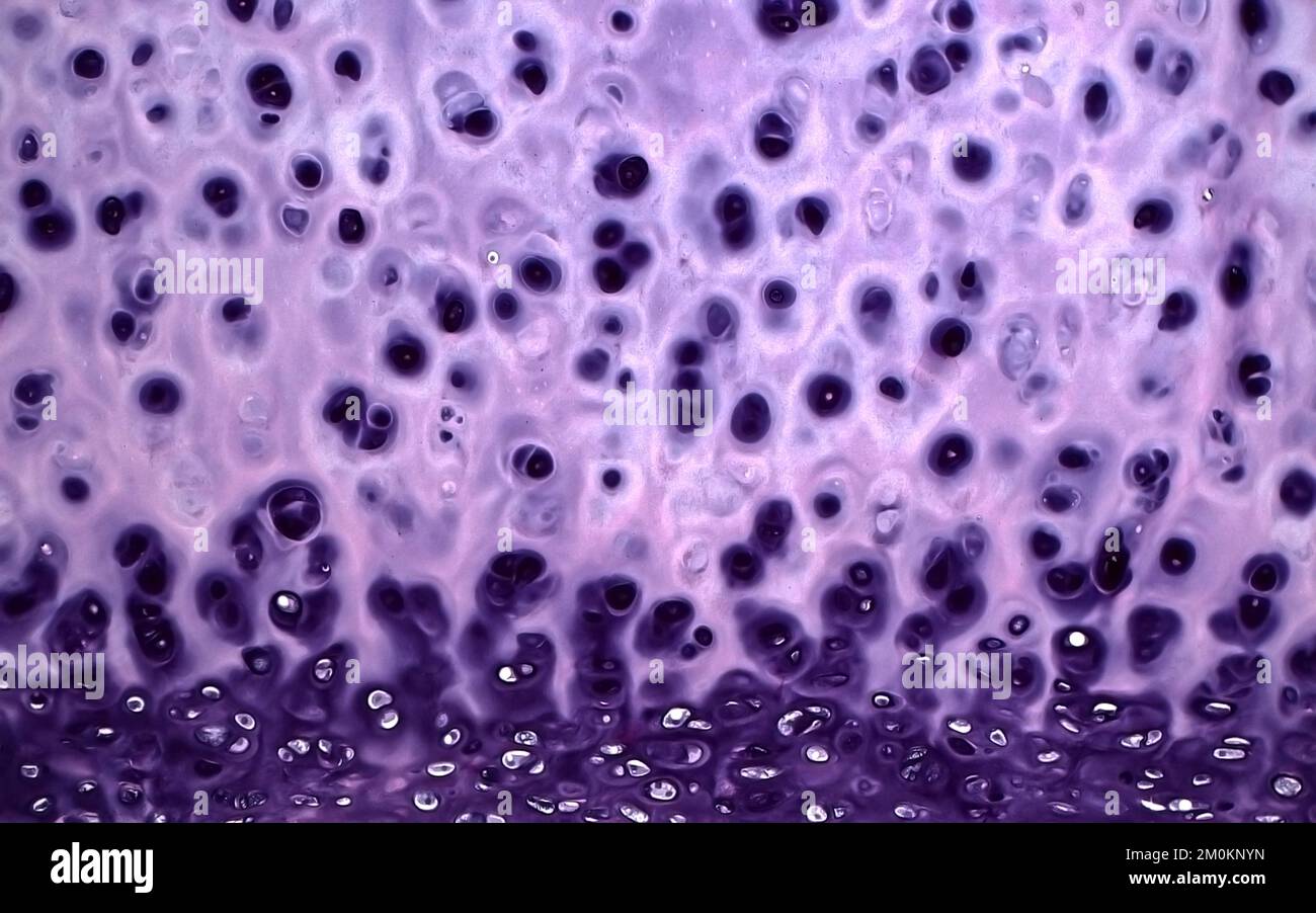 Human cartilage, light micrograph Stock Photo - Alamy