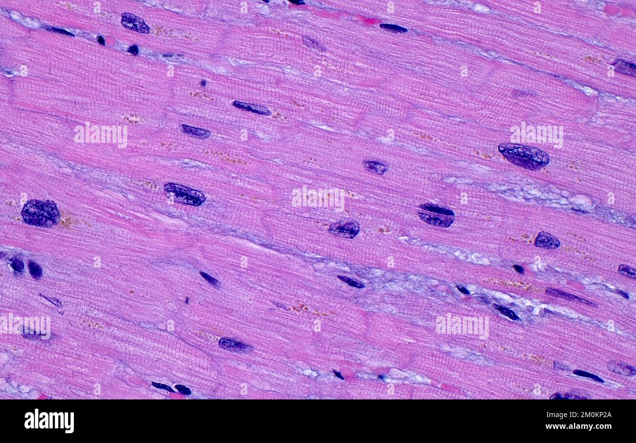 Heart muscle cells, light micrograph Stock Photo - Alamy