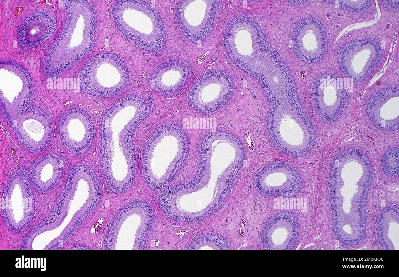 Testis epididymis, light micrograph Stock Photo - Alamy