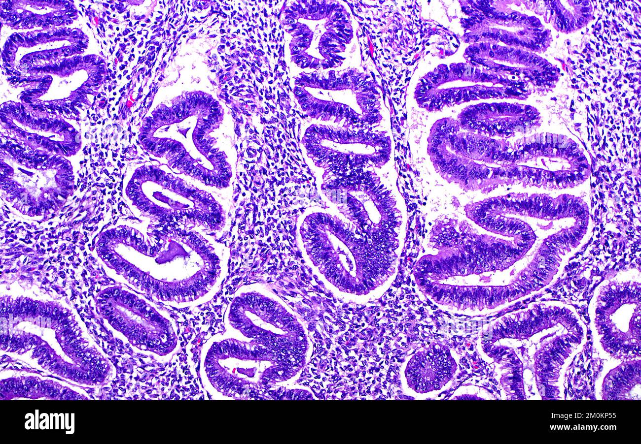 Uterus secretory phase, light micrograph Stock Photo - Alamy